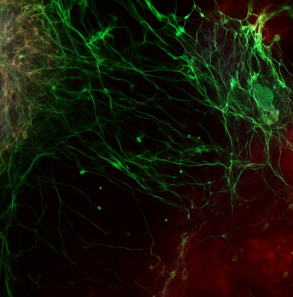 ISS, evacuazione medica Crew-11: orari e dettagli del rientro - Tom's ...